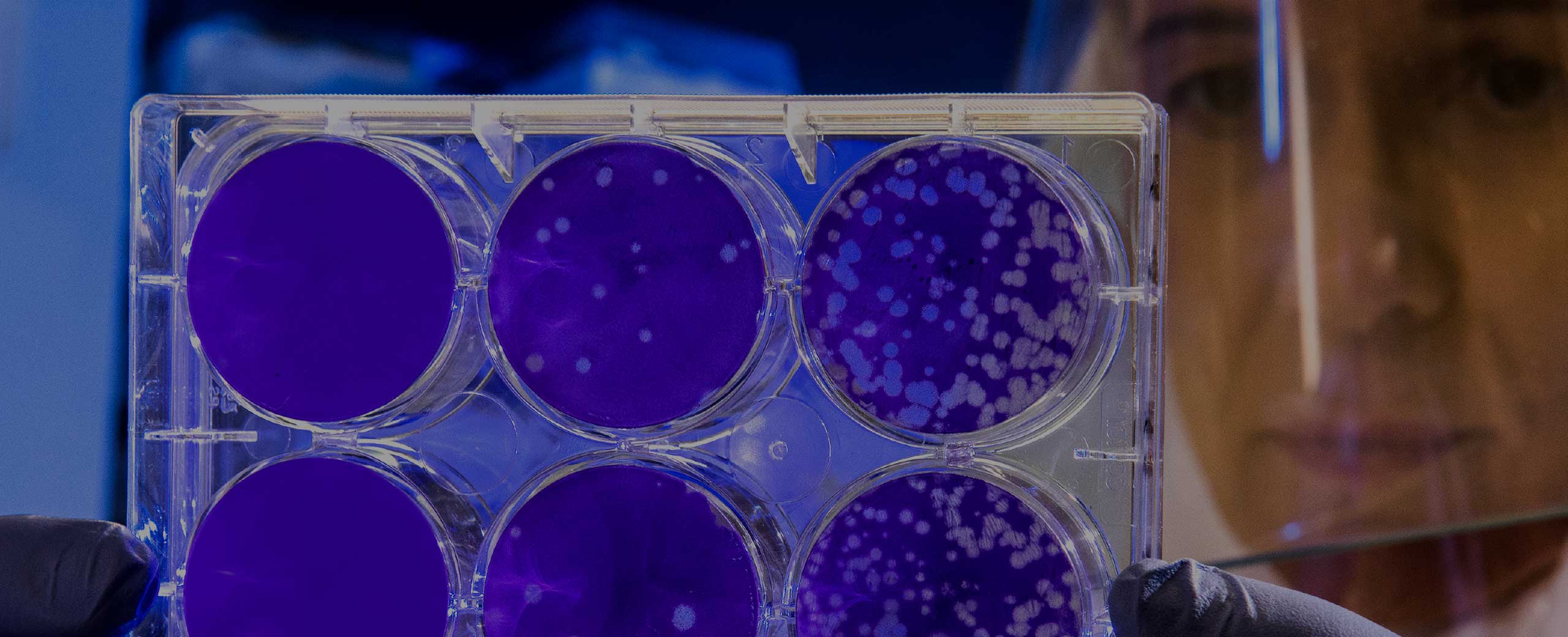 About – PBD Project